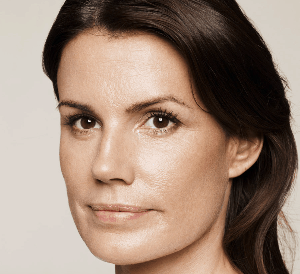Skinboost: de ideale dagcrème onderhuids - ABC Clinic