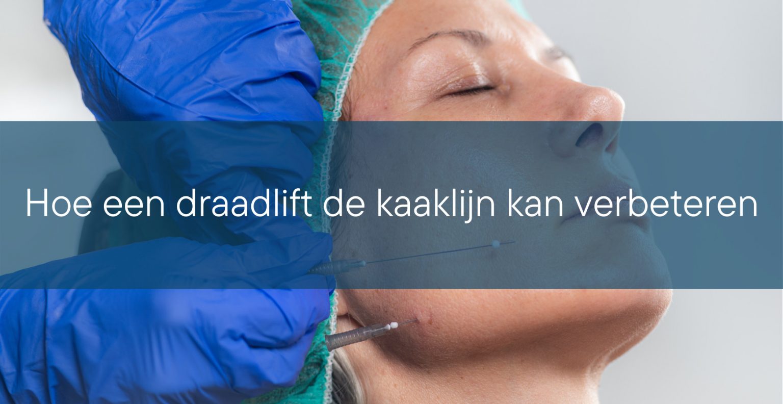 Hoe een draadlift de kaaklijn kan verbeteren (tip)