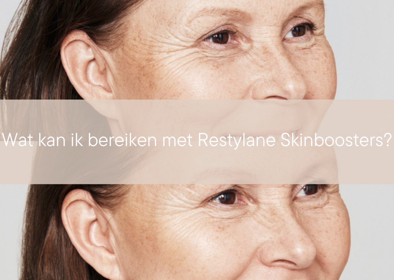 Wat kan ik bereiken met Restylane Skinboosters?