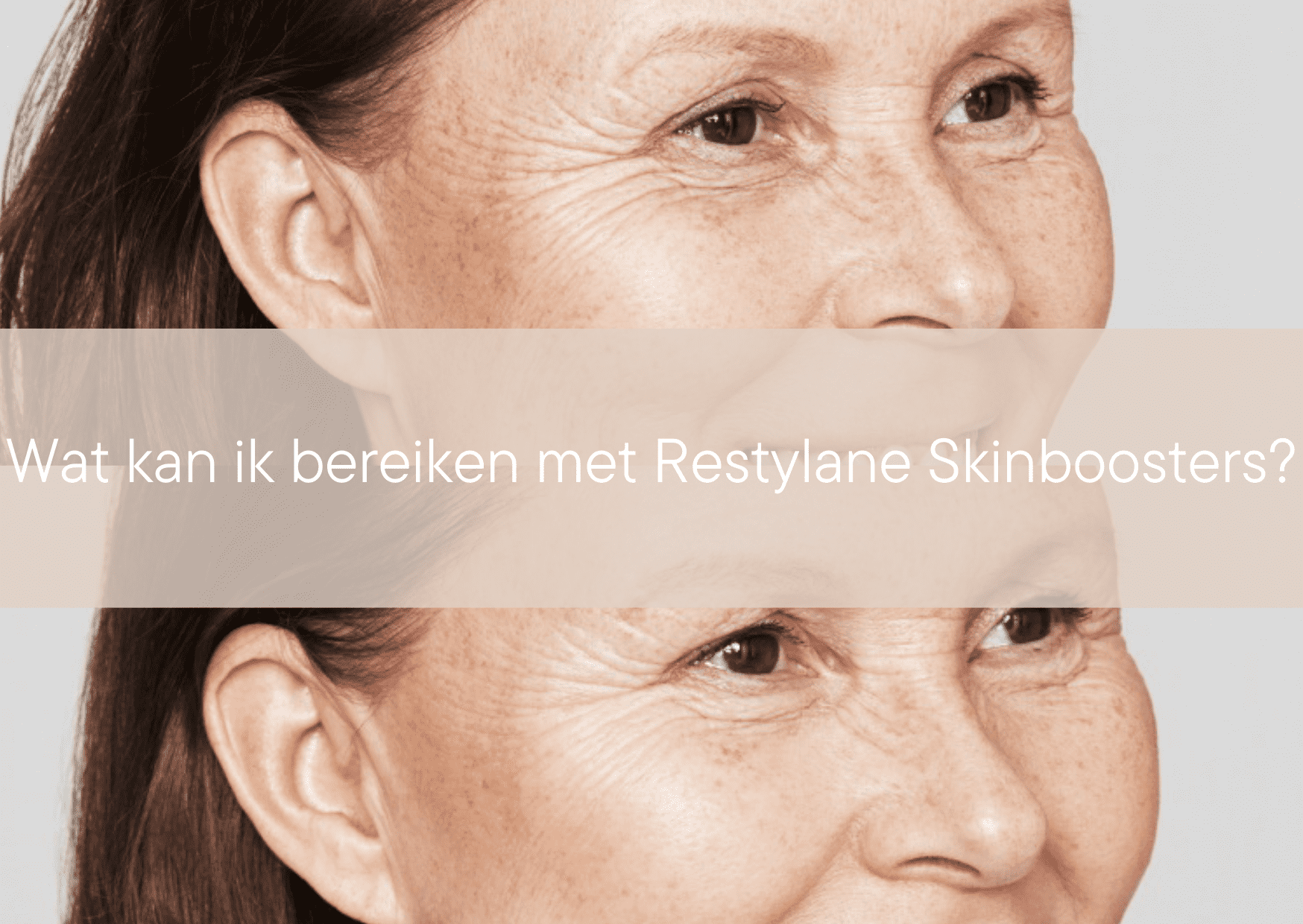 Wat kan ik bereiken met Restylane Skinboosters?