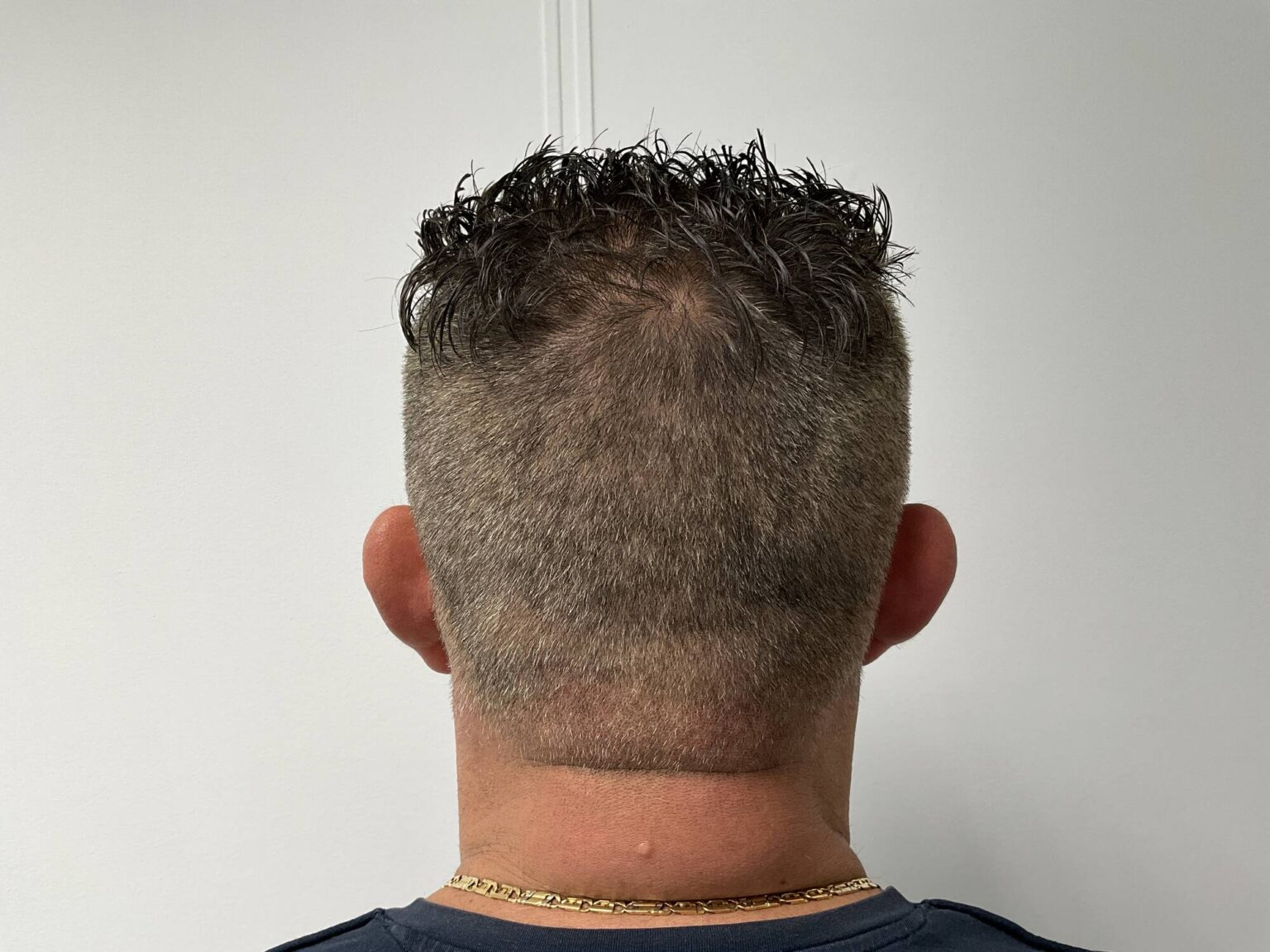 Flaporen | Oorzaken, gevolgen en oplossingen